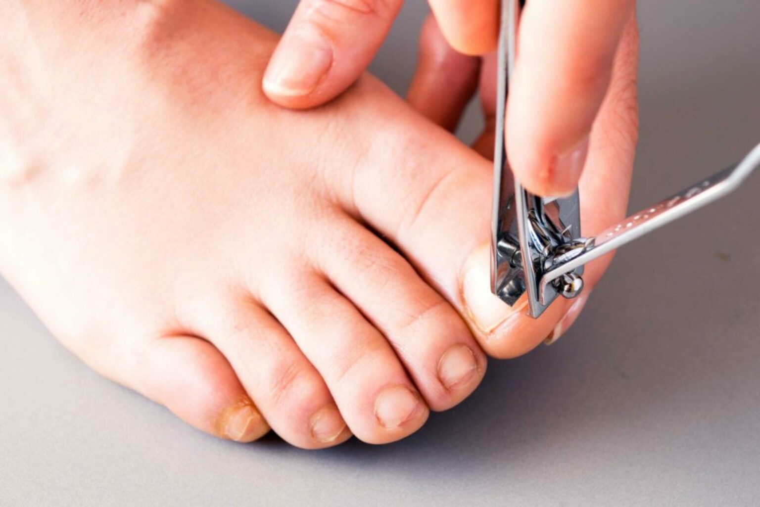 Fix your Ingrown Toenails: Unlock your Foot Freedom Today
